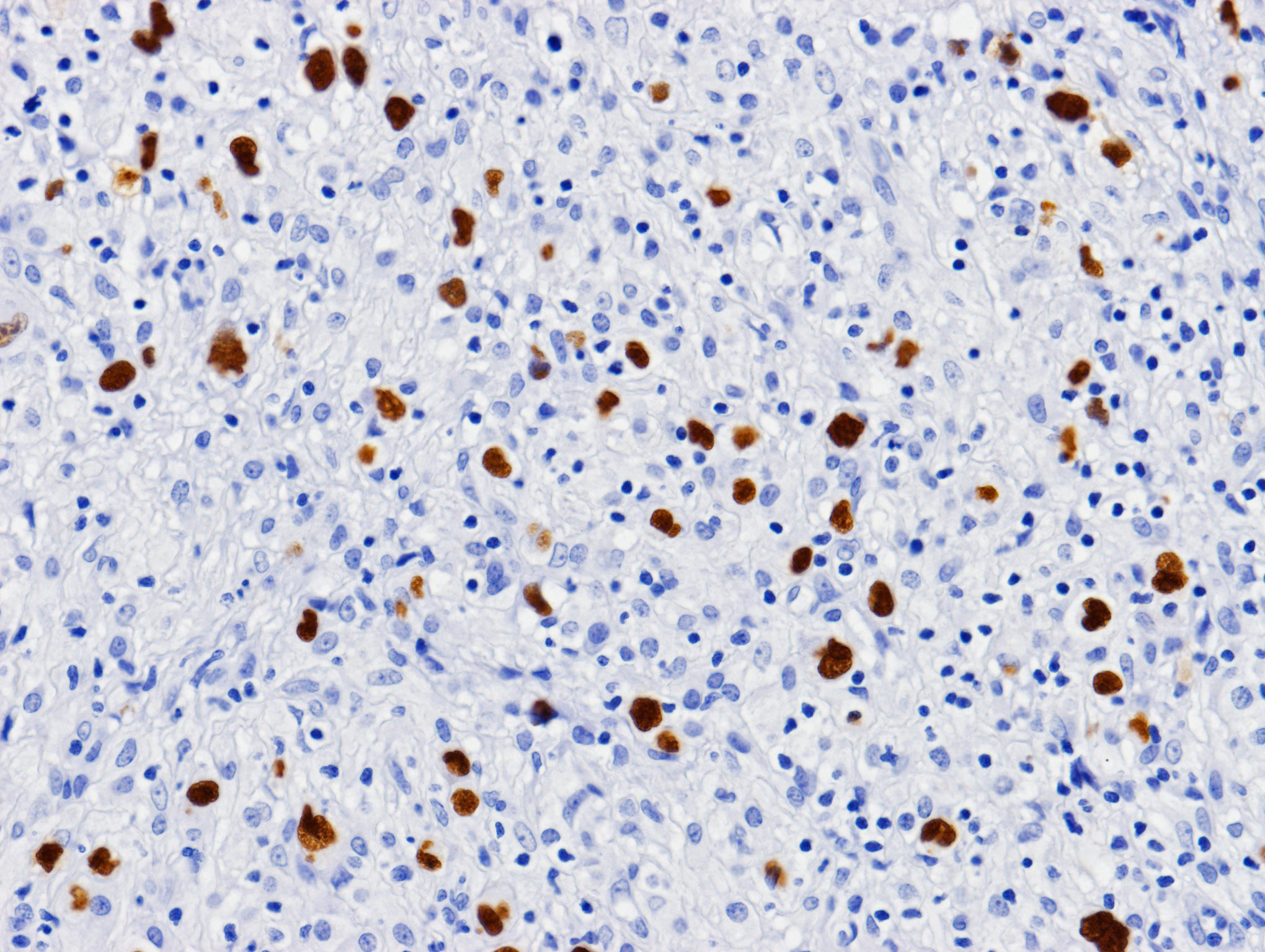 EBER-CISHプローブ(AT用) | ニチレイバイオサイエンス