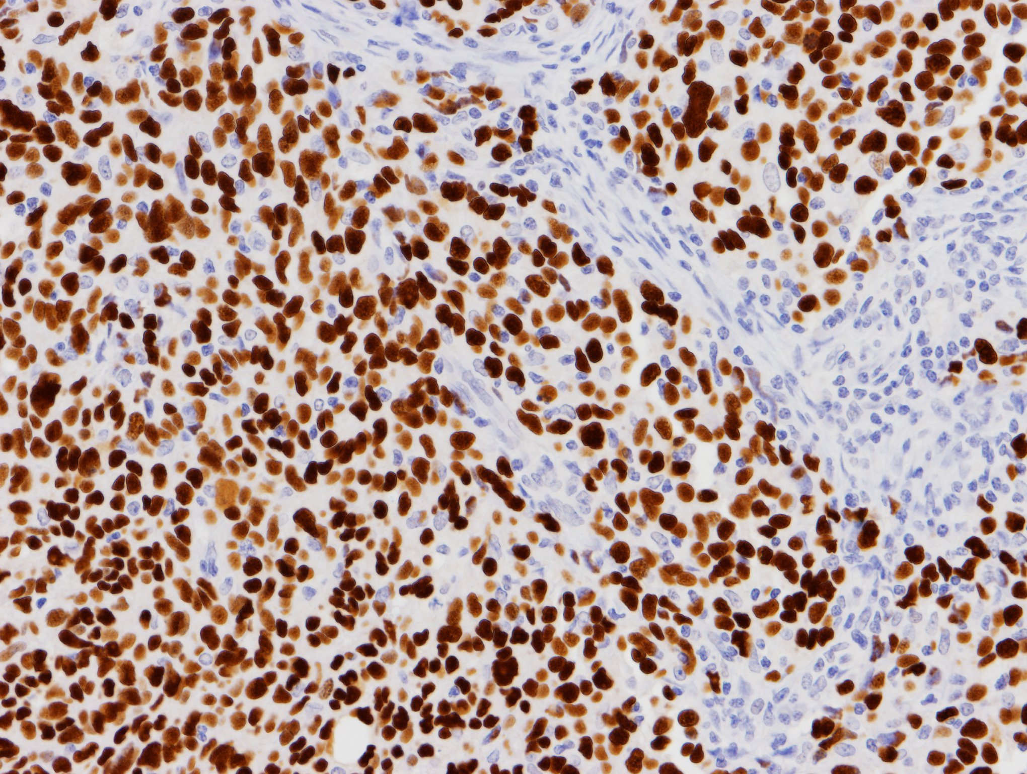 EBER-CISHプローブ(AT用) | ニチレイバイオサイエンス