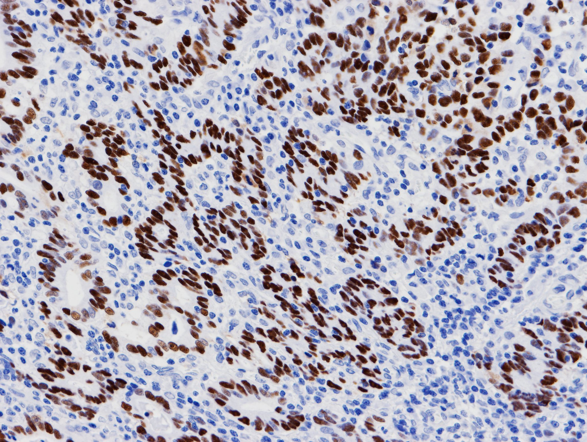 EBER-CISHプローブ(AT用) | ニチレイバイオサイエンス