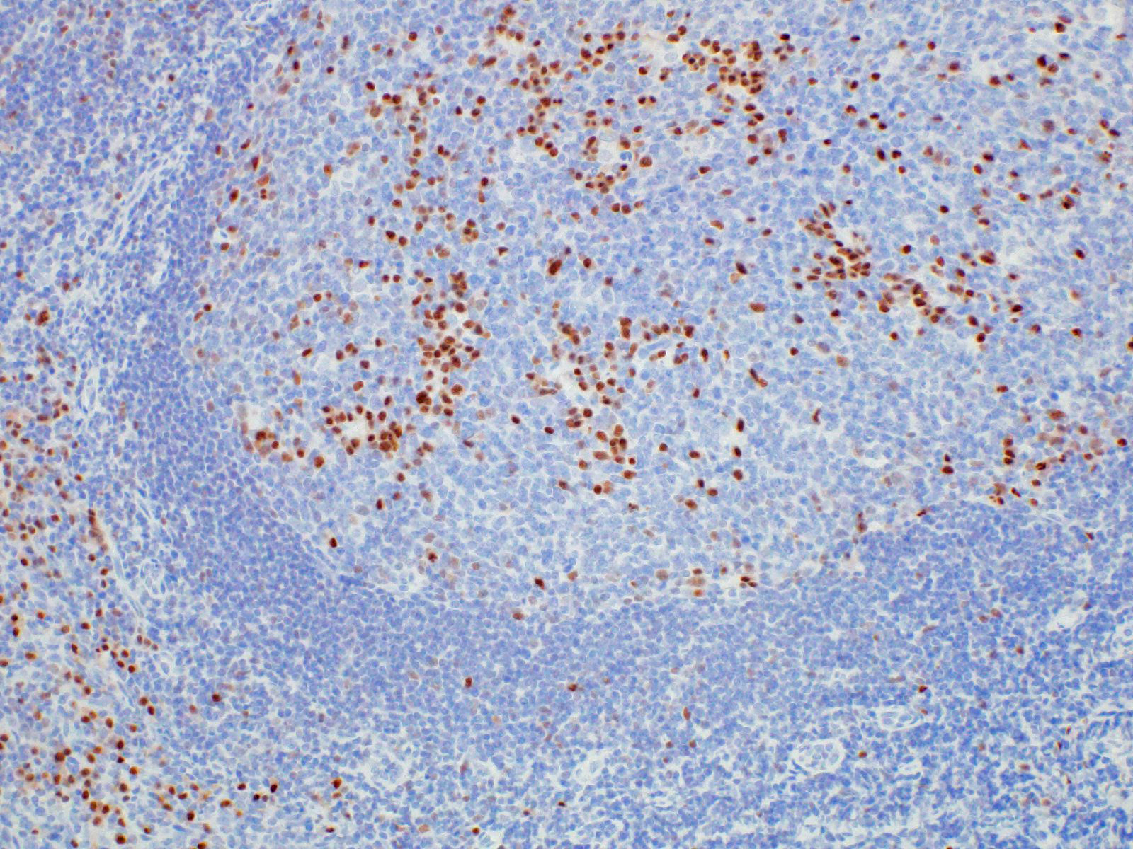 MUM1 | ニチレイバイオサイエンス