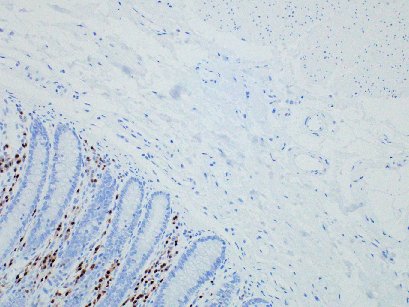 MUM1 | ニチレイバイオサイエンス